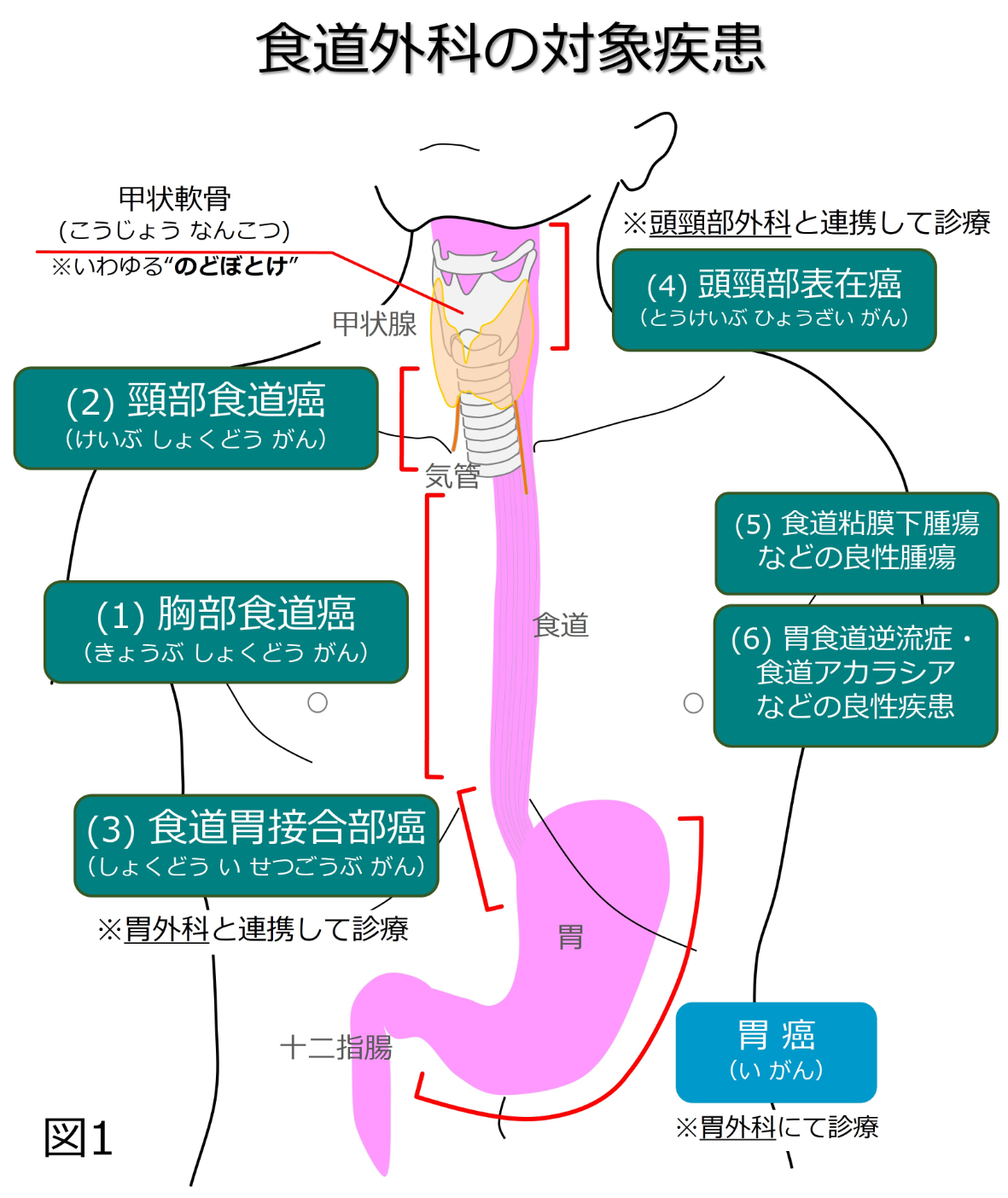 食道弁 ゆるい: 胃と食道の逆流を防止する弁 – NMVCP